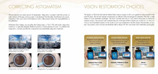 Laser Cataract Surgery Premium Custom Brochure - Patient Education Concepts