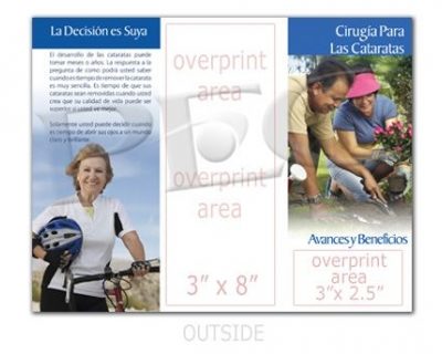 Spanish Cataract Surgery Brochure (8.5″x11″) - Patient Education Concepts