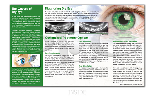 Dry Eye & MGD Brochure (8.5″x14″) - Patient Education Concepts