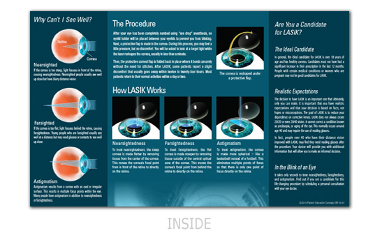 All Laser LASIK Brochure (8.5″x14″) - Patient Education Concepts