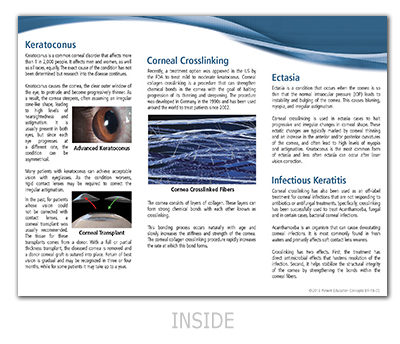 NEW Corneal Crosslinking Brochure (8.5″x11″) - Patient Education Concepts