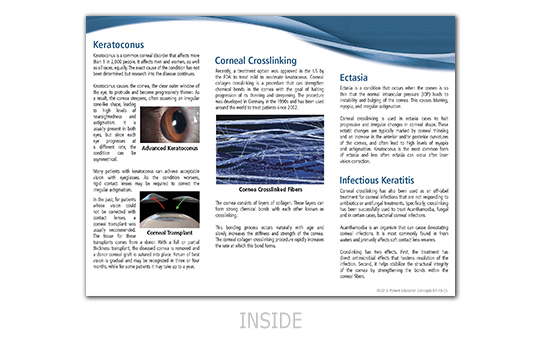Corneal Crosslinking Brochure (8.5″x11″) - Patient Education Concepts