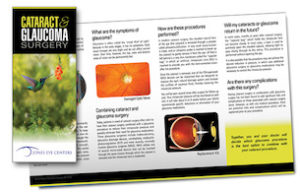 Cataract & Glaucoma Surgery Brochure (8.5″x14″) - Patient Education ...