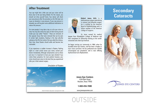 Secondary Cataract (YAG) Brochure (8.5″x11″) - Patient Education Concepts