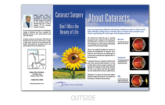 Cataract Surgery Don’t Miss the Beauty of Life Brochure (9.75″x14 ...
